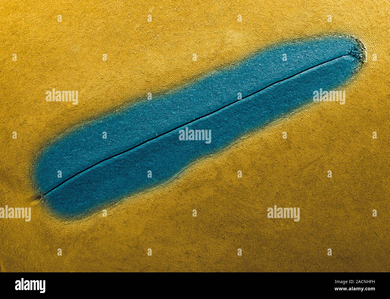 Vetch seed. Coloured scanning electron micrograph (SEM) of a close-up ...