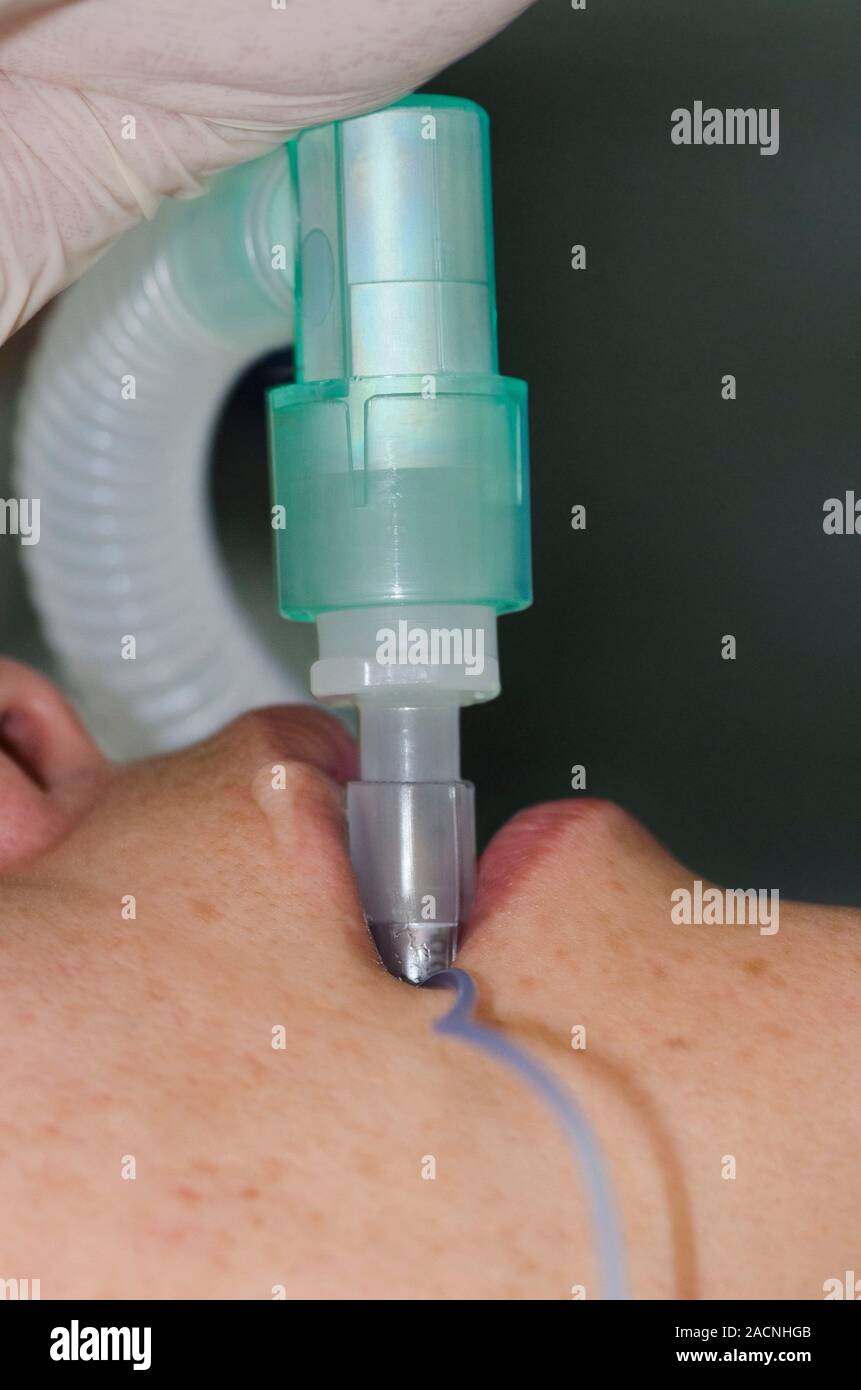 Intubated patient. Patient that has been intubated prior to surgery ...
