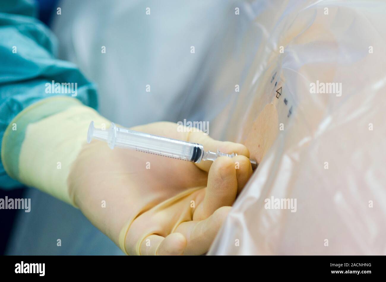 Spinal anaesthesia. Anaesthesiologist injecting a local anaesthetic ...
