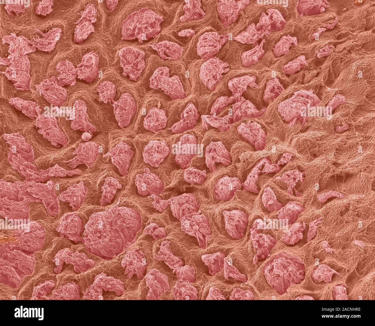 Human tongue. Coloured scanning electron micrograph (SEM) showing the ...