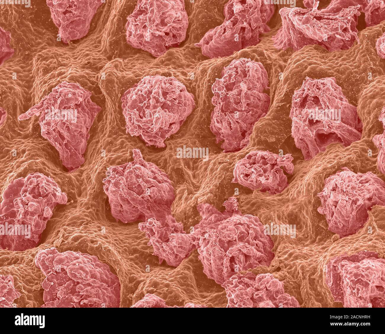 Human tongue. Coloured scanning electron micrograph (SEM) showing the ...