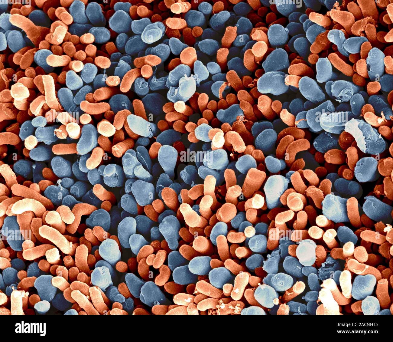 Rod and cone cells of the eye. Coloured scanning electron micrograph ...