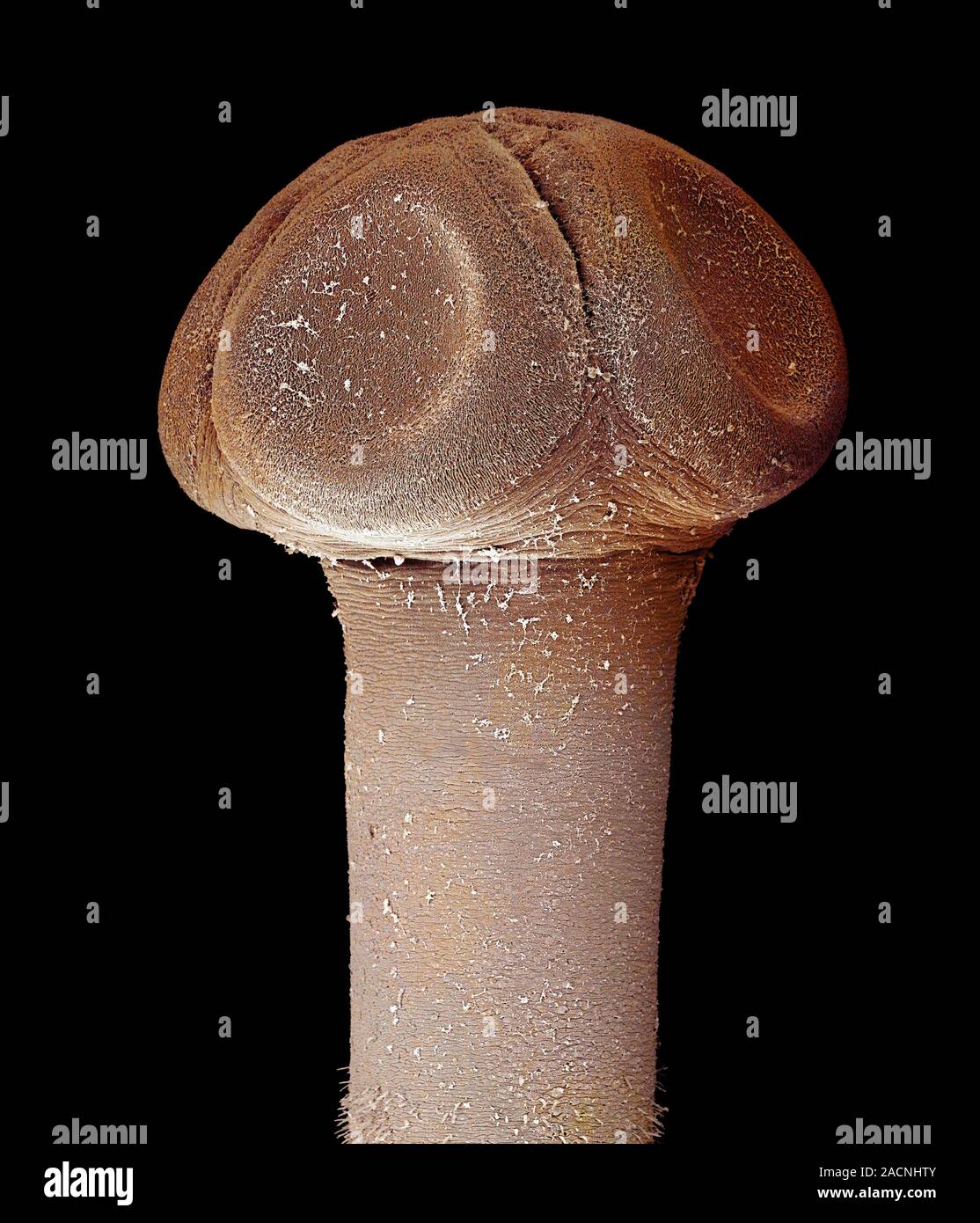 Tapeworm head. Coloured scanning electron micrograph of the head ...