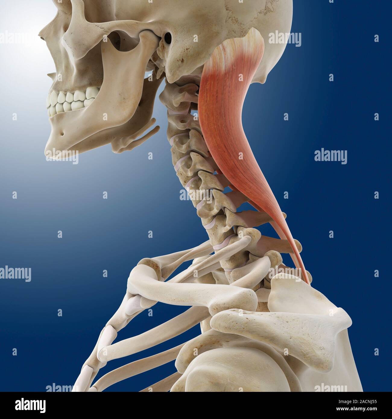 Neck muscle. Computer artwork showing the splenius capitis muscle of ...
