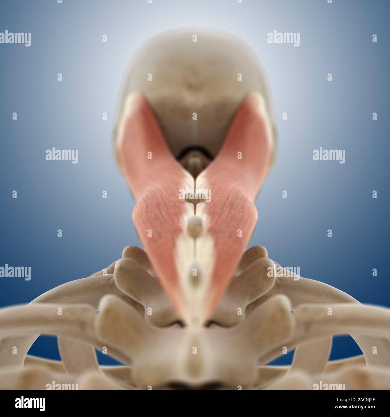 Neck muscle. Computer artwork showing the splenius capitis muscle of ...