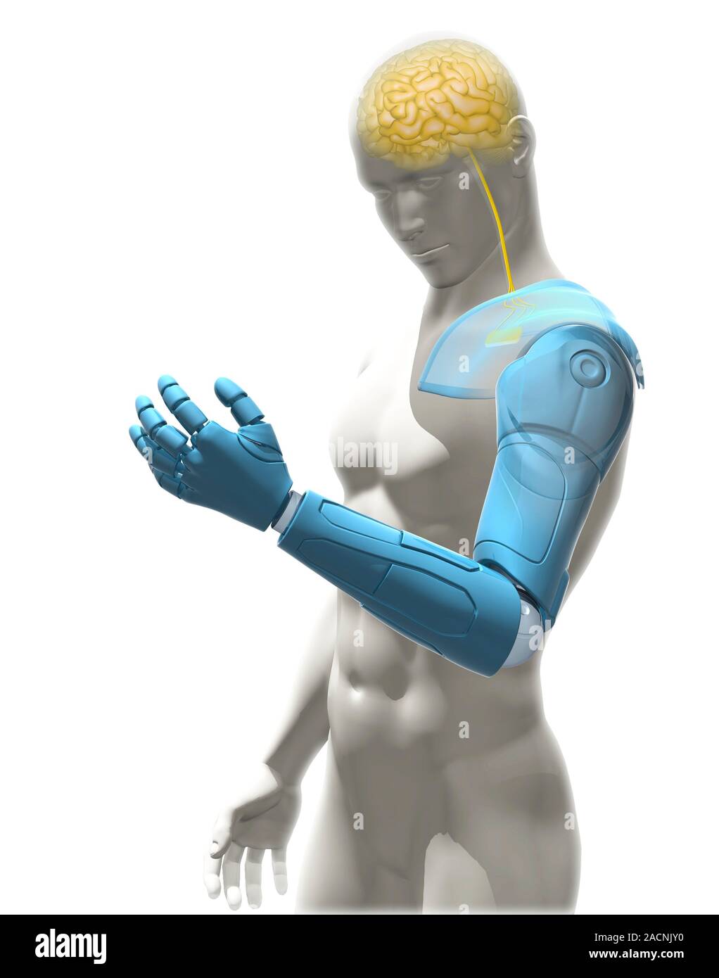 Bionic arm. Computer artwork or a man whose left arm has been replaced ...