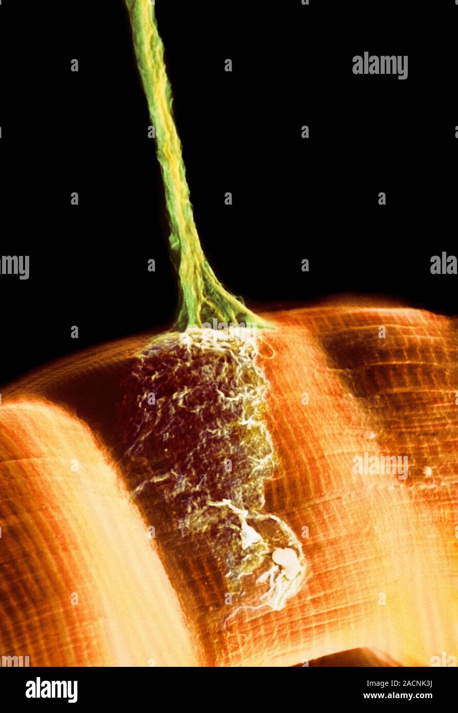 Synapse. Coloured scanning electron micrograph (SEM) of a neuromuscular ...