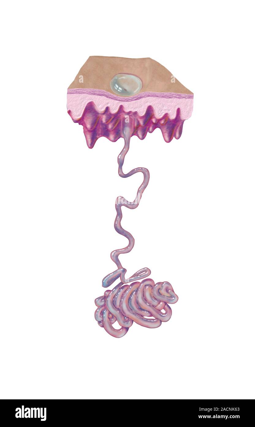 Sweat gland in skin. Artwork of a section of human skin (top) with the ...