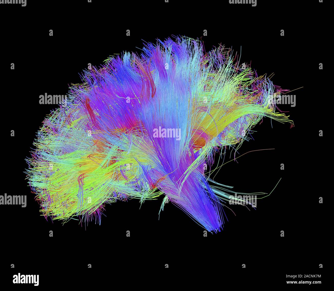 White matter fibres. Coloured 3D diffusion spectral imaging (DSI) scan ...