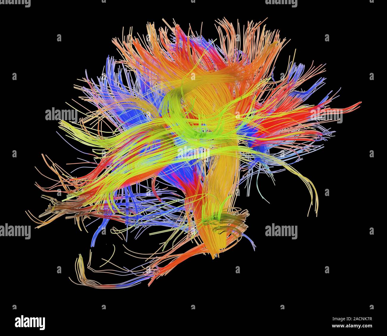 White matter fibres. Coloured 3D diffusion spectral imaging (DSI) scan ...