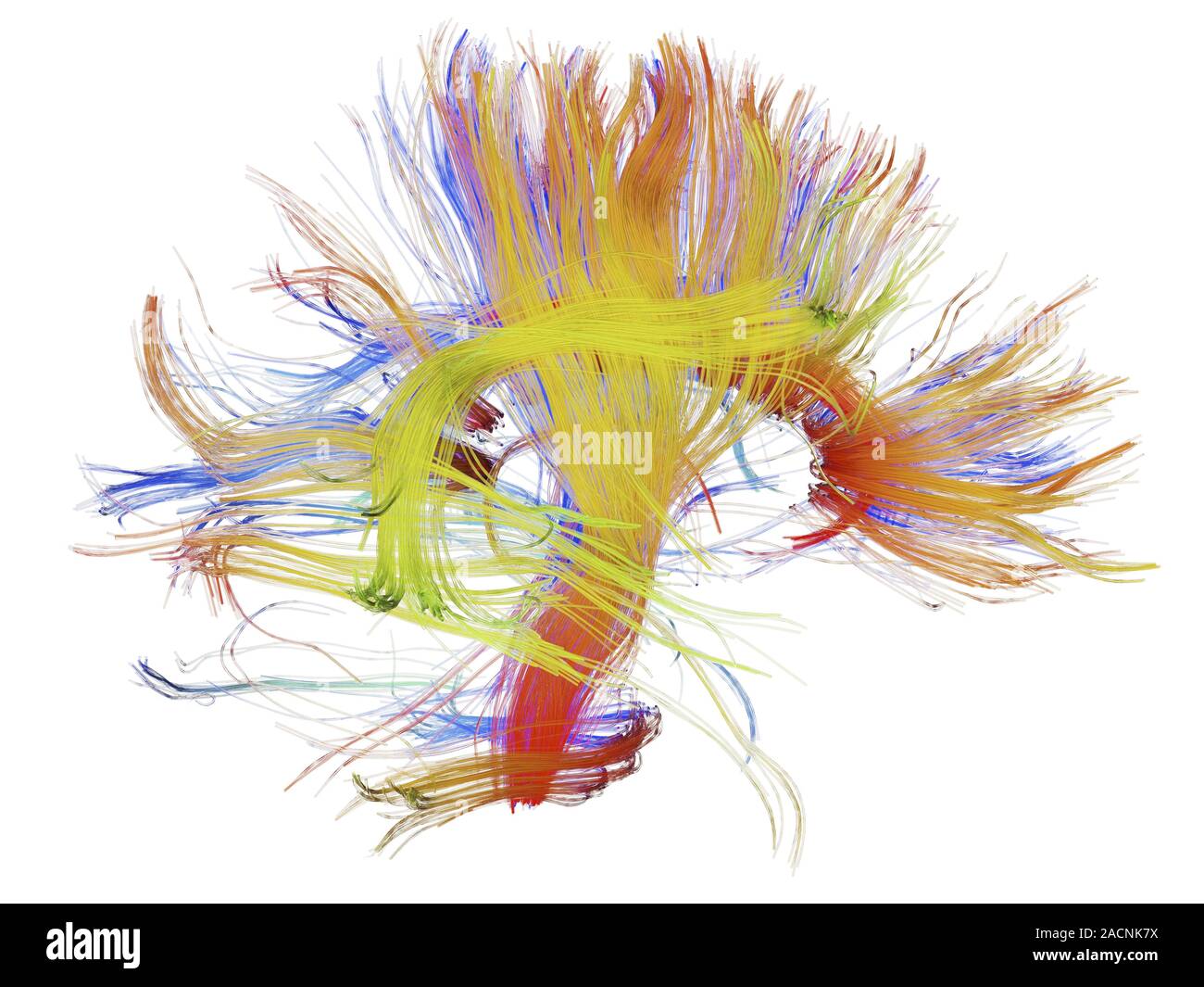 White matter fibres. Coloured 3D diffusion spectral imaging (DSI) scan ...