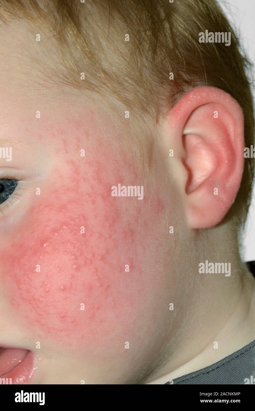 Not for use in Television Not for use in Television Juvenile spring ...