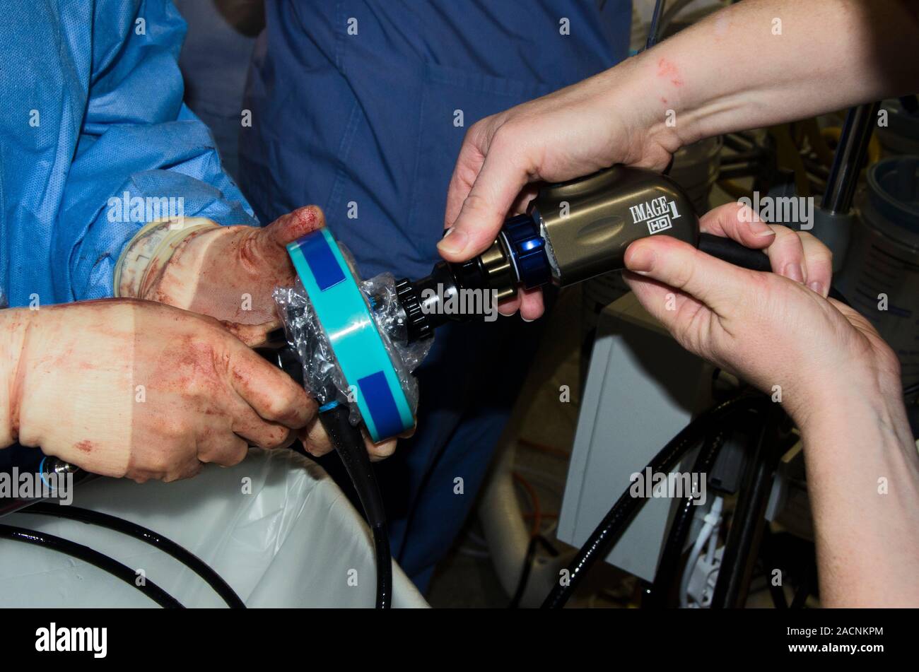 Gallstone surgery. Surgeons inserting a laparoscope (abdominal ...