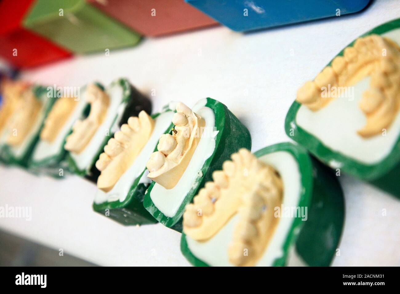 Dental prosthesis production. Plaster moulds of patients' teeth that ...
