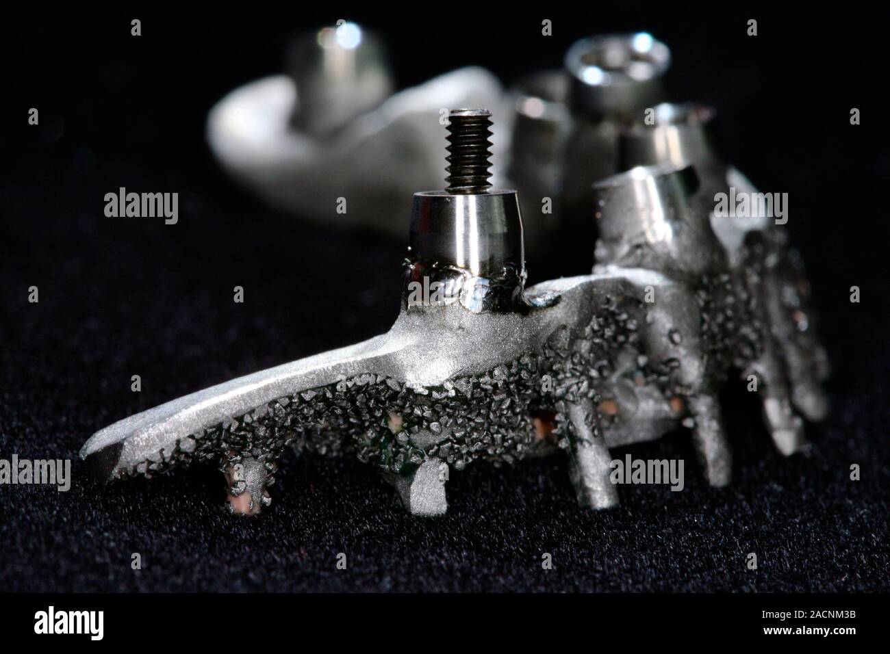 Dental prosthesis production. Metal frame from a dental prosthesis ...