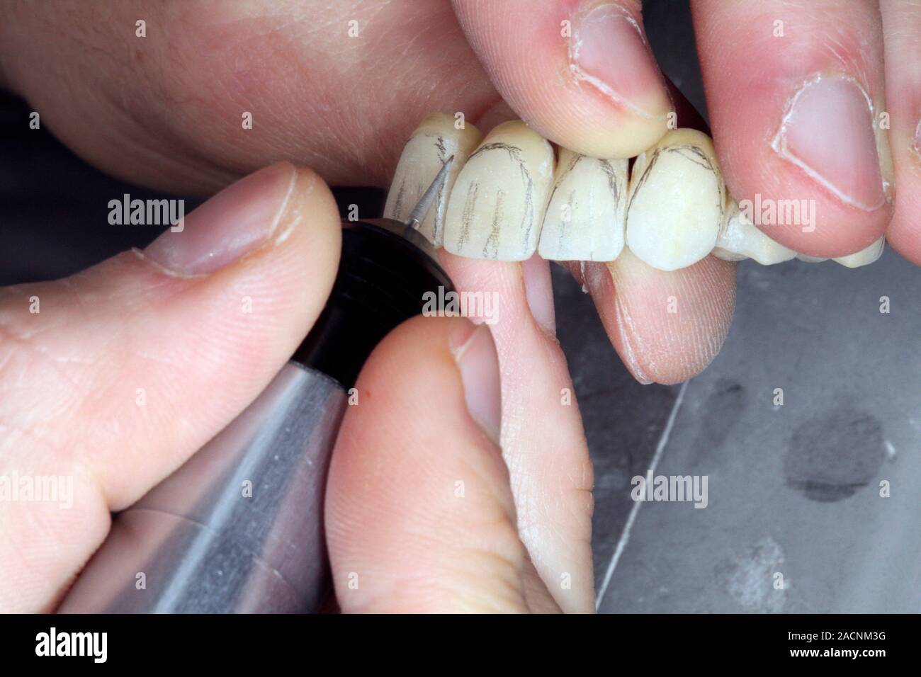 Dental prosthesis production. Worker shaping tooth for a custom dental ...