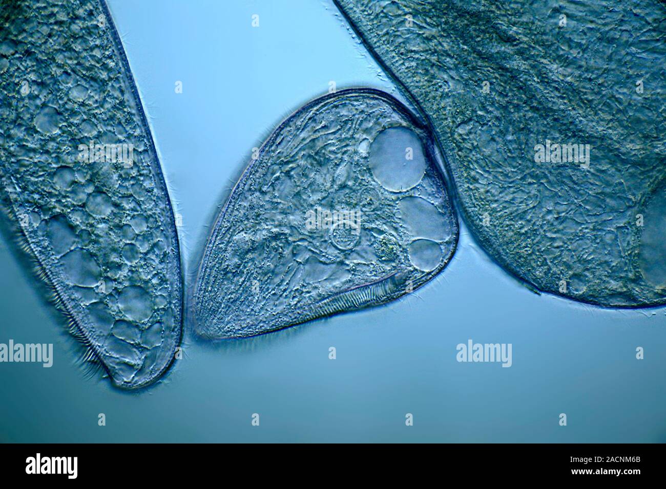 Blepharisma protozoa. Differential interference contrast micrograph of ...