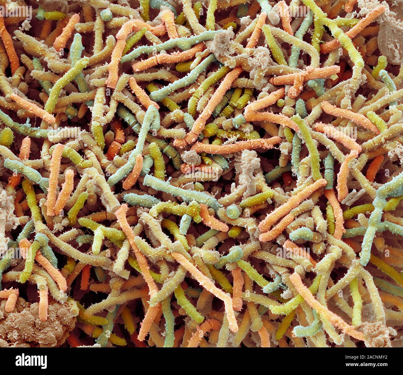 Bacteria in bird droppings. Coloured scanning electron micrograph (SEM ...