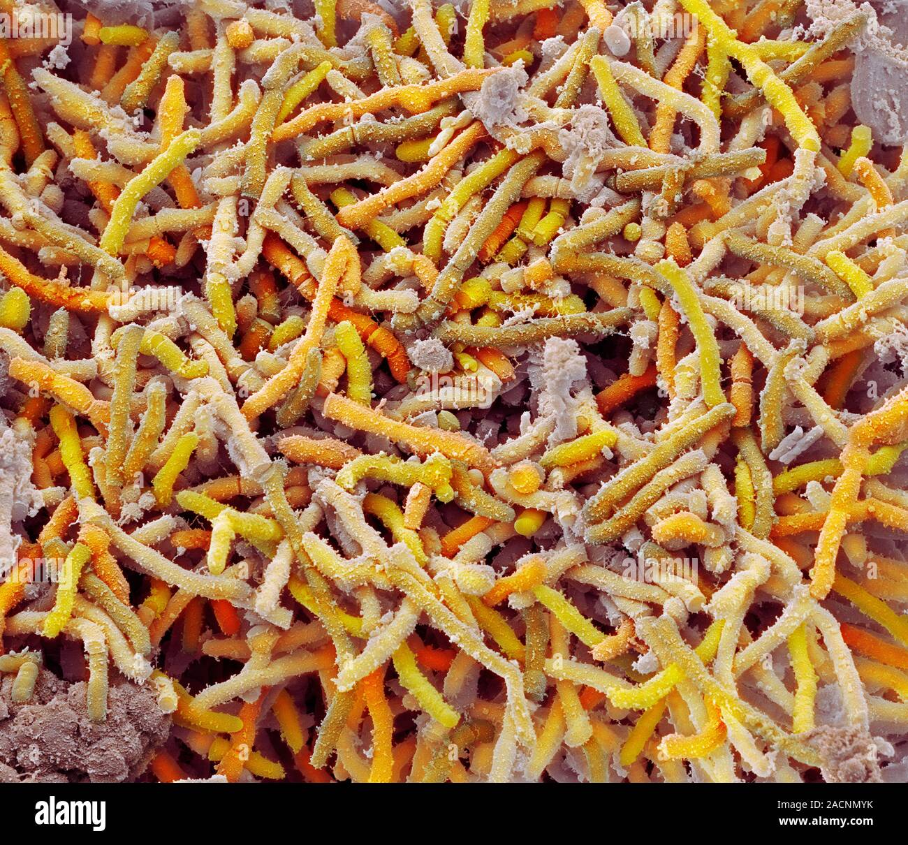 Bacteria in bird droppings. Coloured scanning electron micrograph (SEM ...