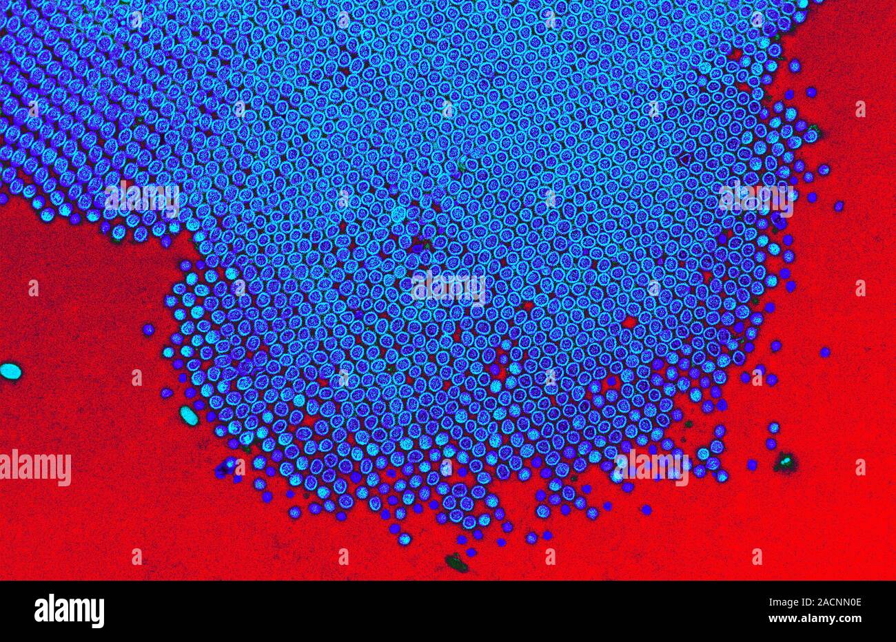 Intestinal brush border. Transmission electron micrograph (TEM) of a ...