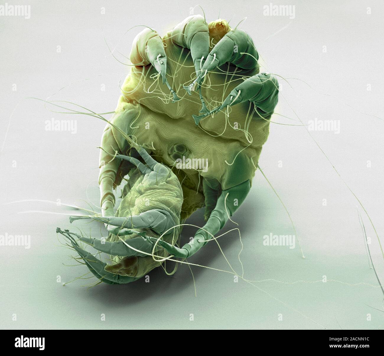Mange mites. Coloured scanning electron micrograph (SEM) of two mites ...