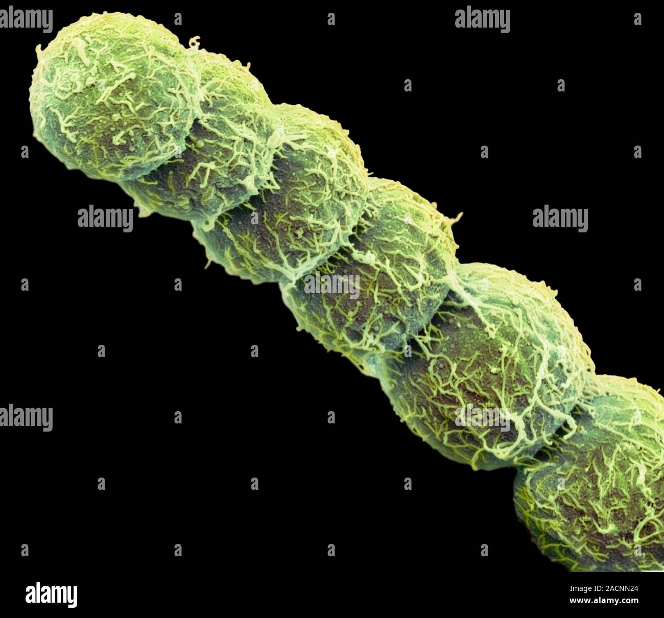 Anabaena algae. Coloured scanning electron micrograph (SEM) of Anabaena ...