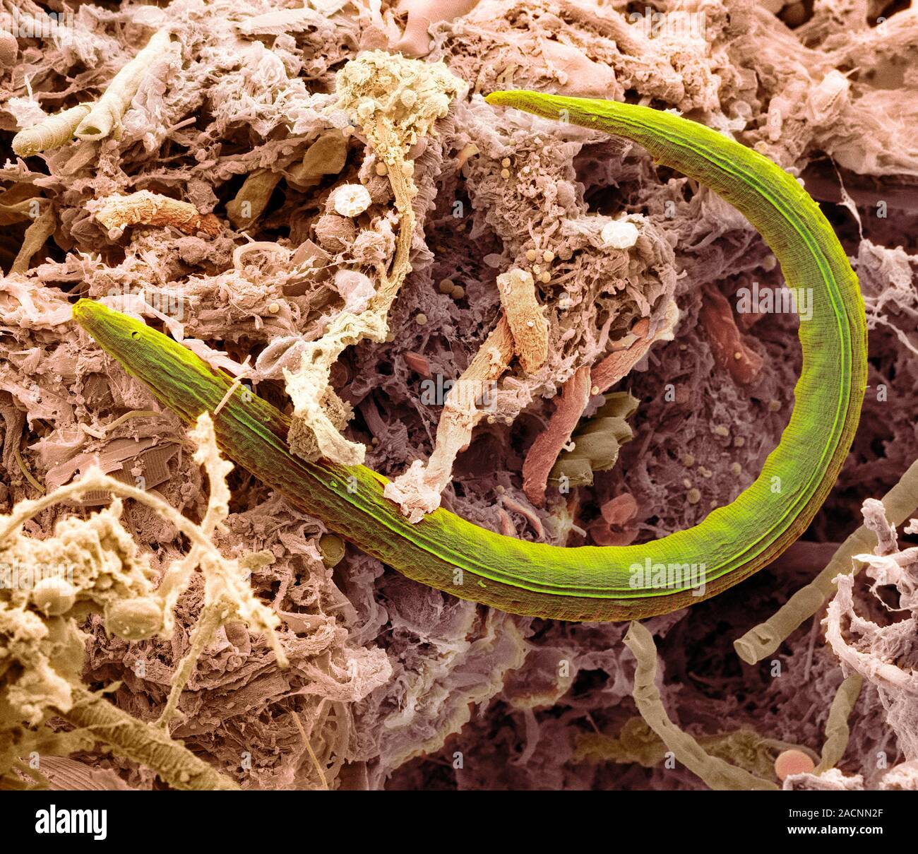 Nematode worm. Coloured scanning electron micrograph (SEM) of a ...