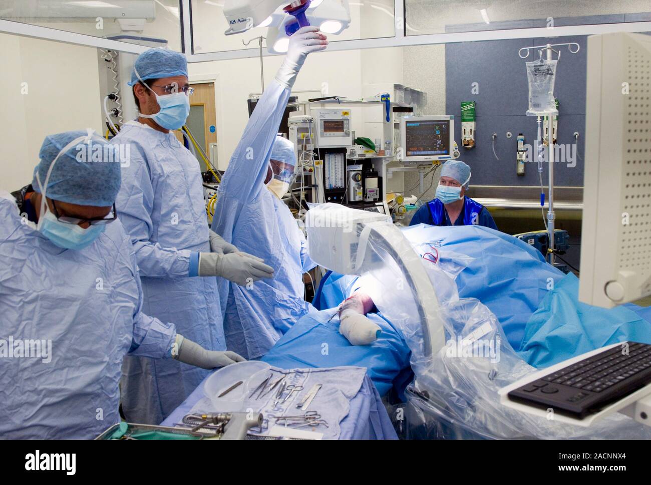 Arm fracture surgery. X-ray machine positioned over a patient's arm ...