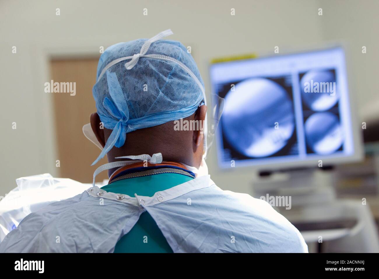 Arm fracture surgery. Surgeon using X-rays of a patient's elbow (centre ...