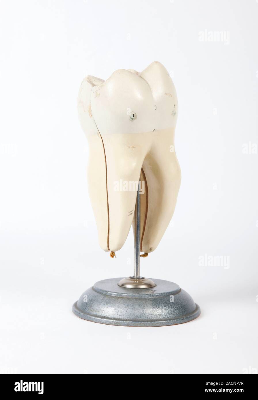 Human tooth. 1950s model showing the external structure of a human ...
