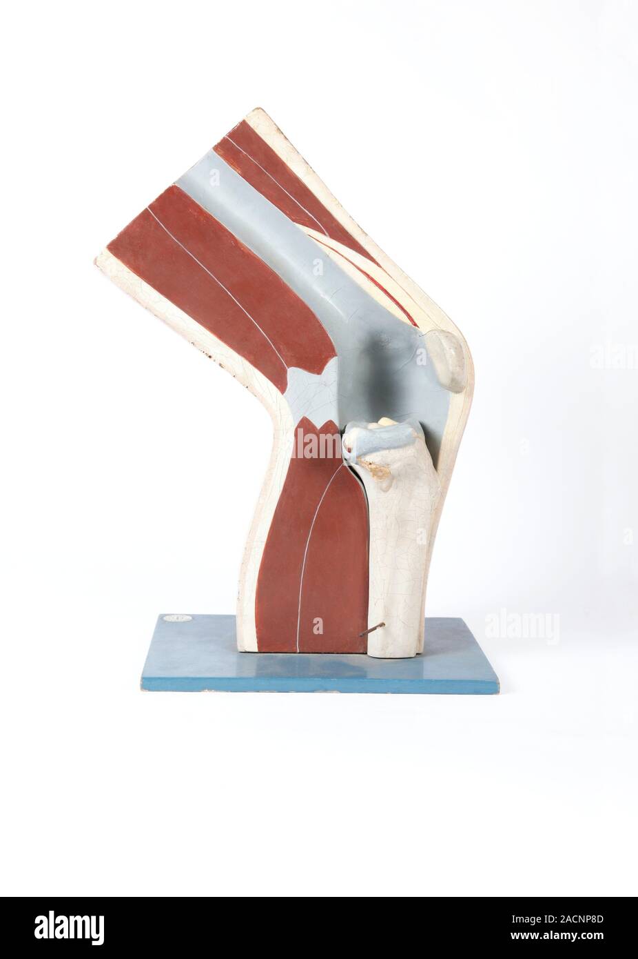 Human knee. 1960s anatomical model showing the internal structure of ...