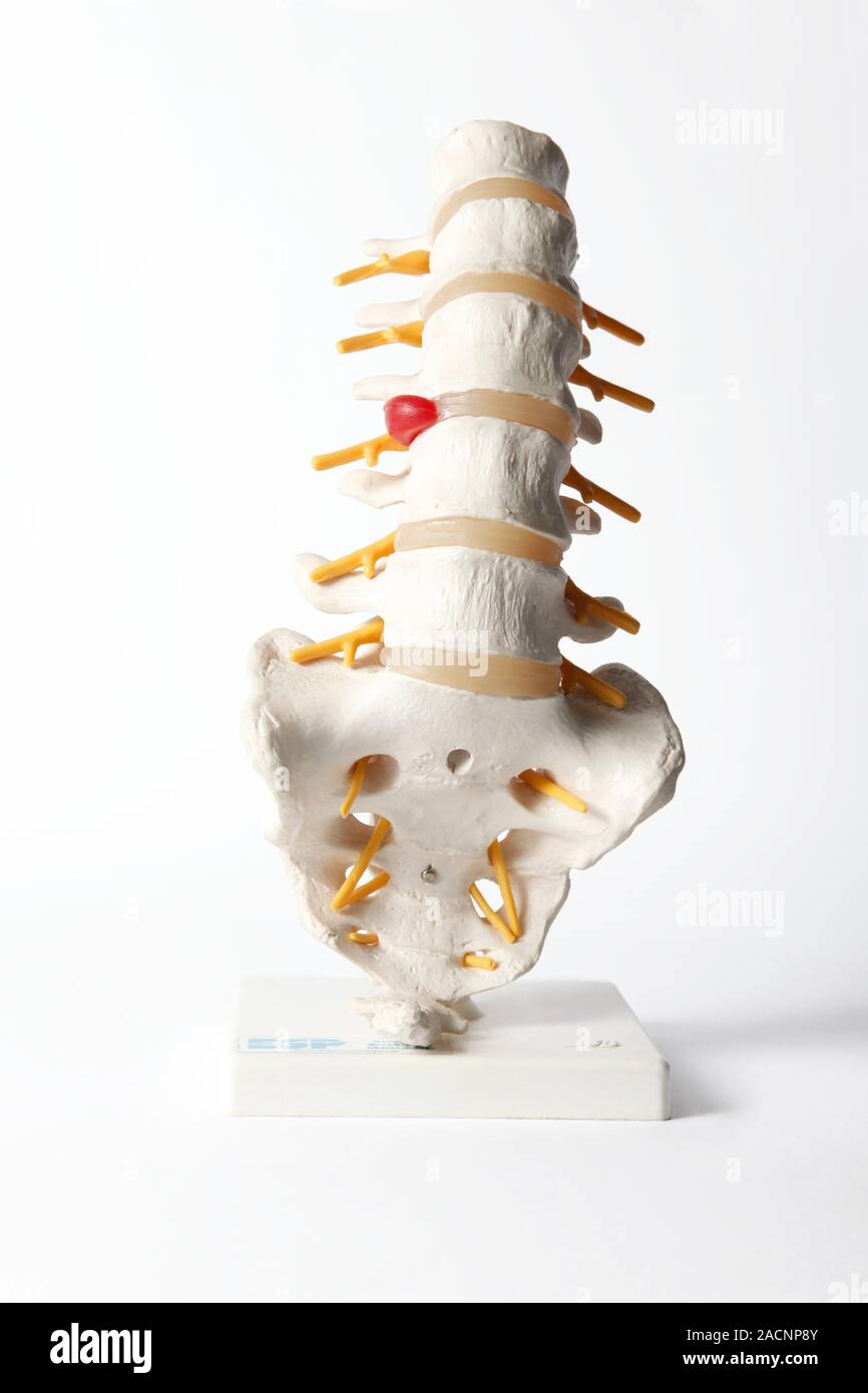 Human spine. Anatomical model (from 1990) showing the lower ...