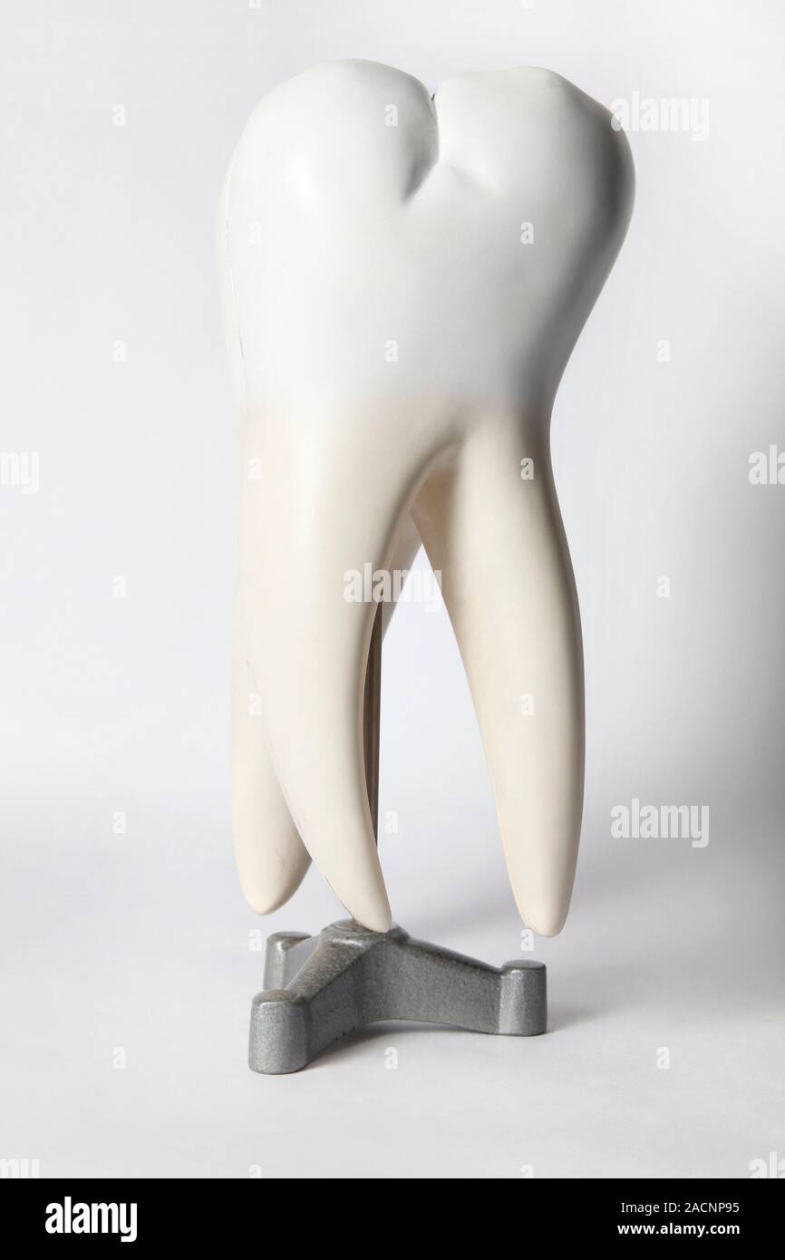 Human tooth. 1950s model showing the external structure of a human ...