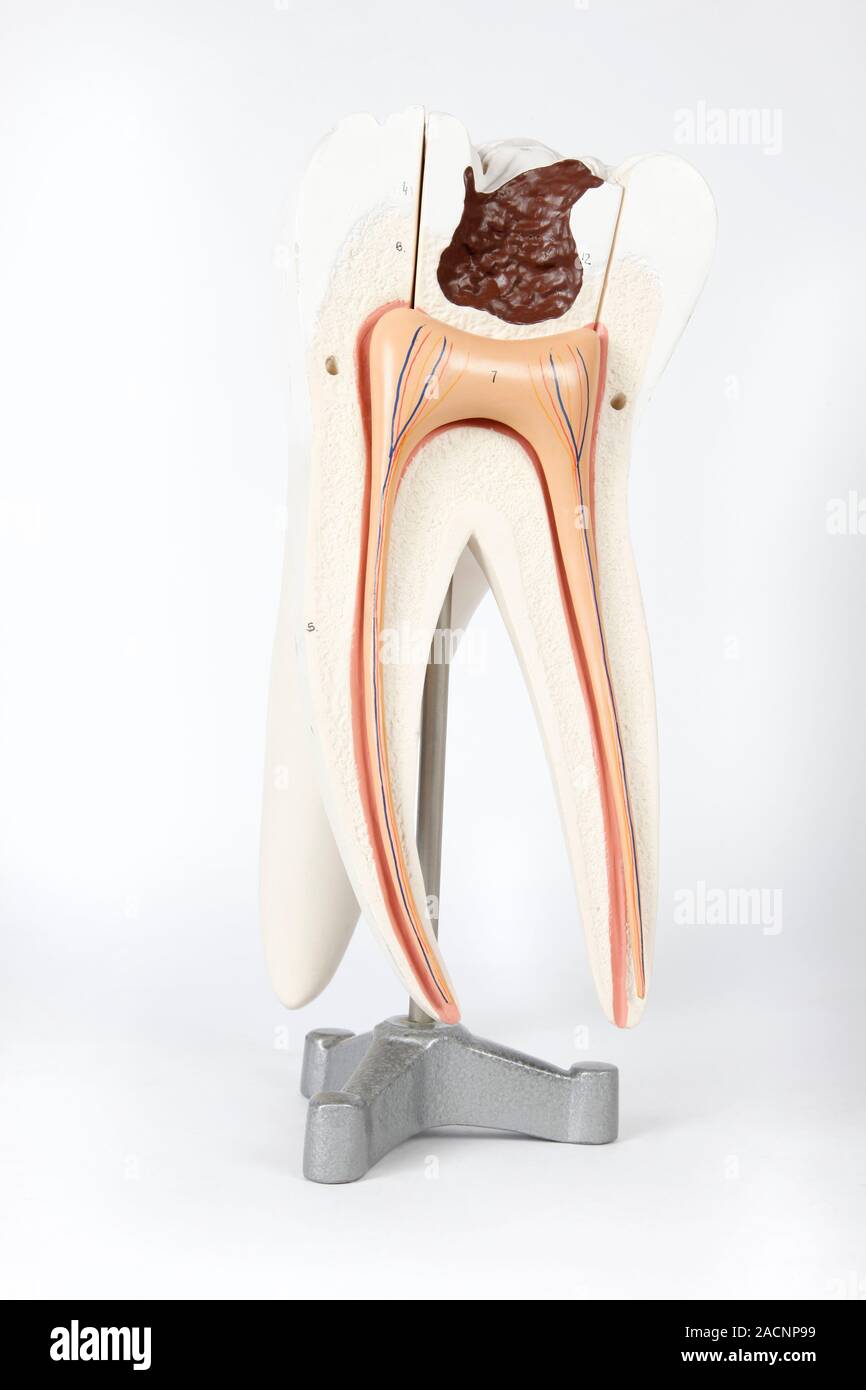Human tooth. 1950s model of a section through a human molar tooth ...