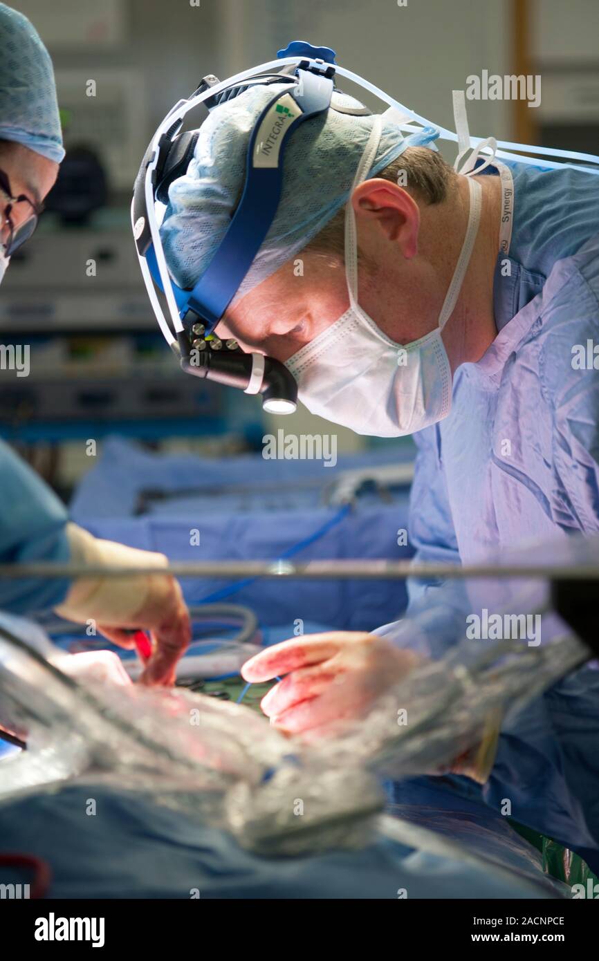 Liver surgery. Surgeon with a head-mounted lamp carrying out liver ...