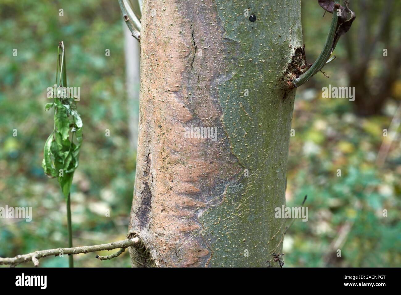 Ash dieback disease. Ash tree affected by ash dieback disease. This ash tree disease is caused ...