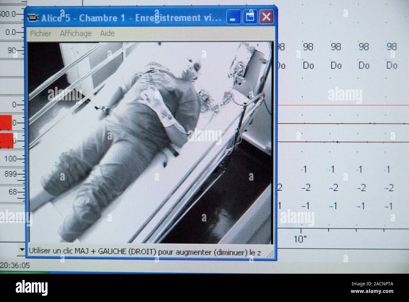Paediatric sleep study. View of an 11-year-old hyperactive boy being ...