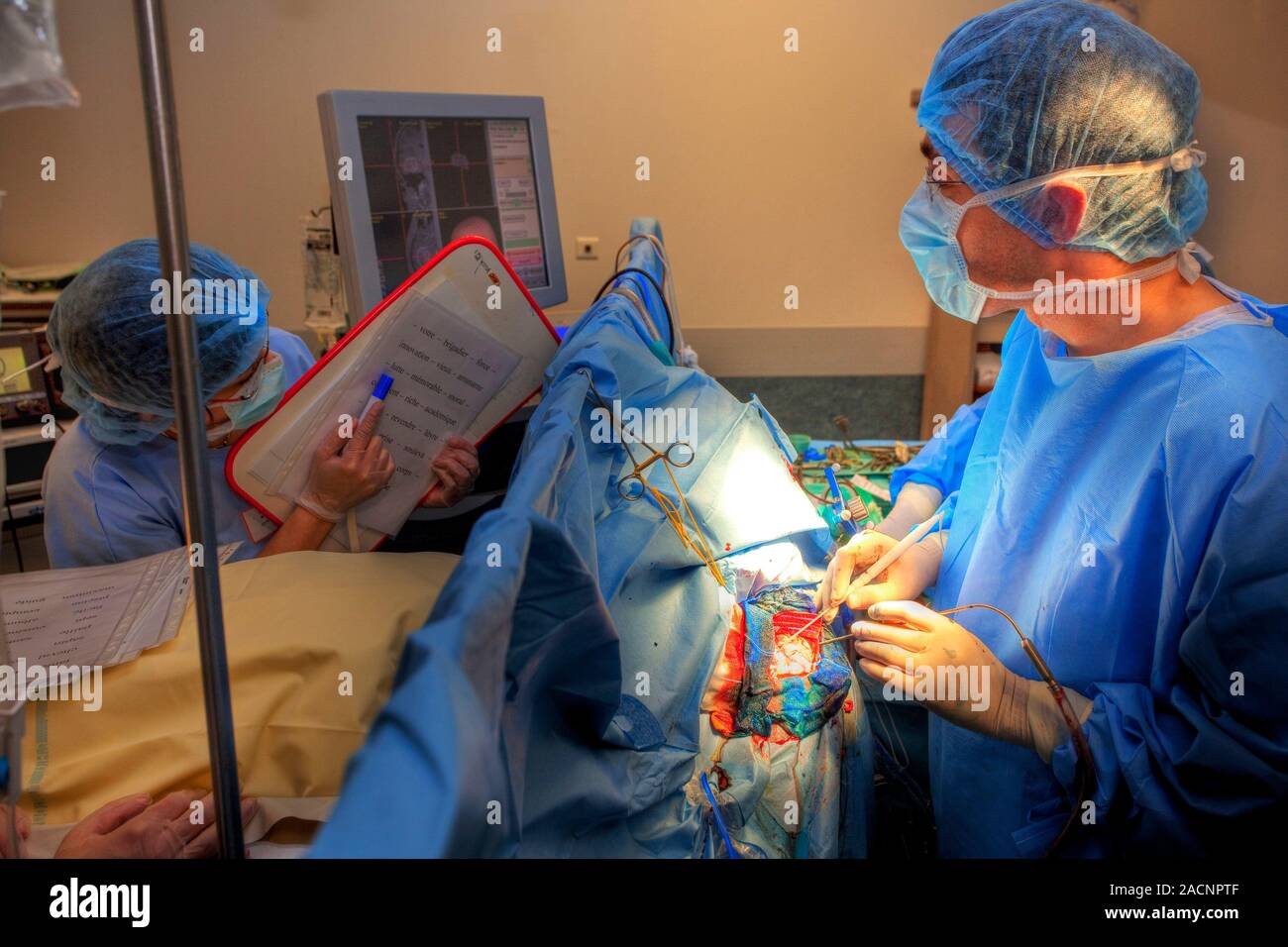 Brain surgery. Patient undergoing surgery to remove a brain tumour ...