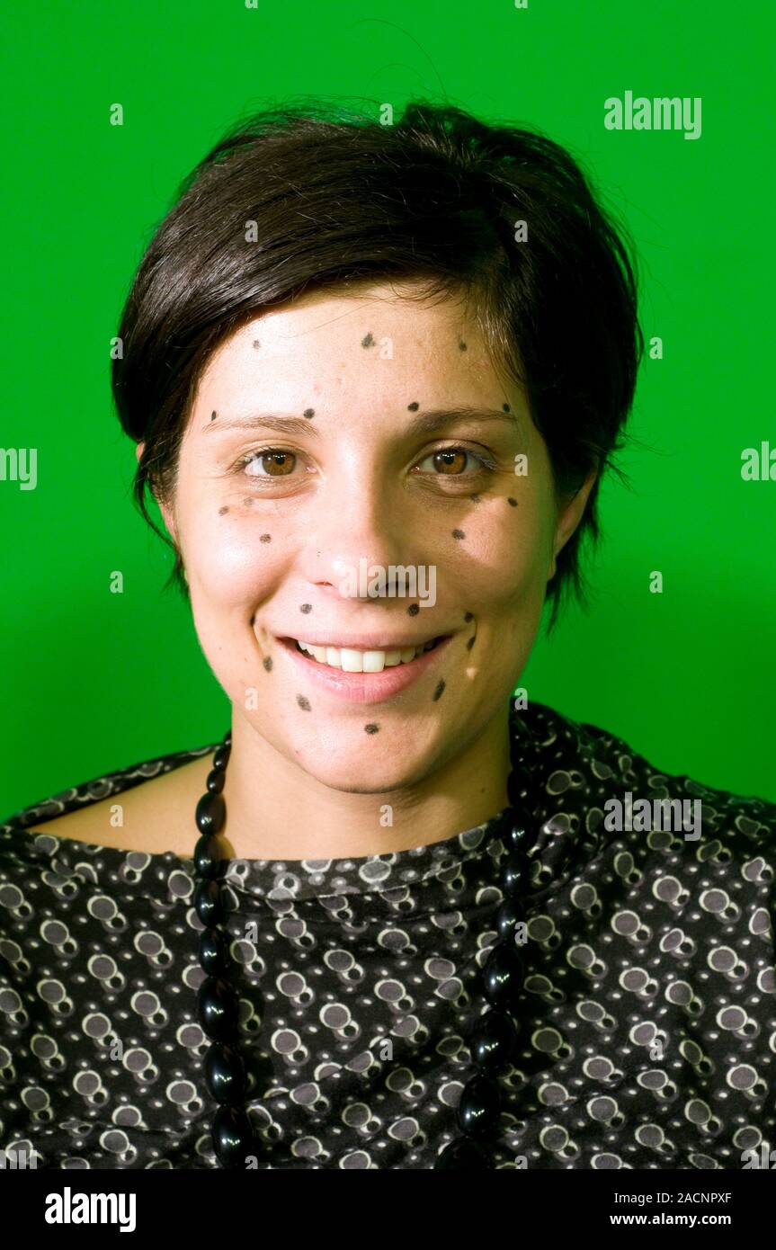 3D virtual avatar construction. Woman with black dots on a her face as ...
