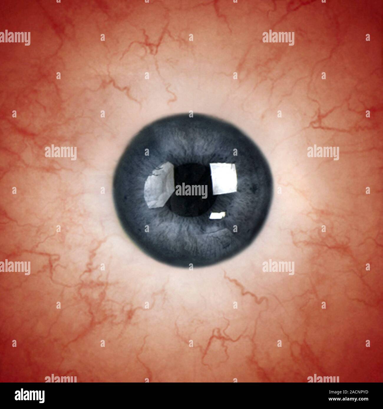 Bloodshot human eye. Close-up of a bloodshot human eye showing the ...
