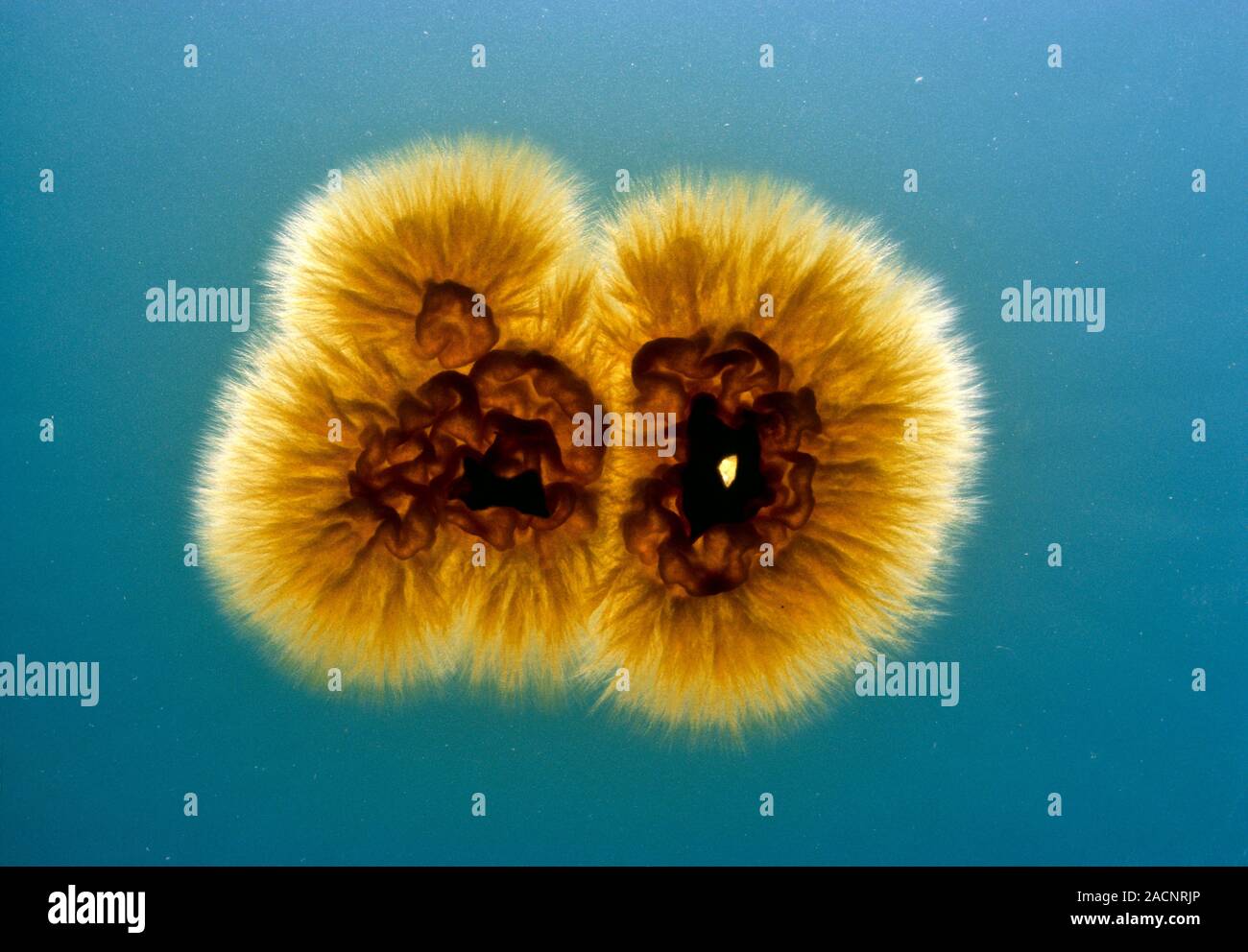 Trichophyton soudanense fungus. This fungus is the most common cause of ...