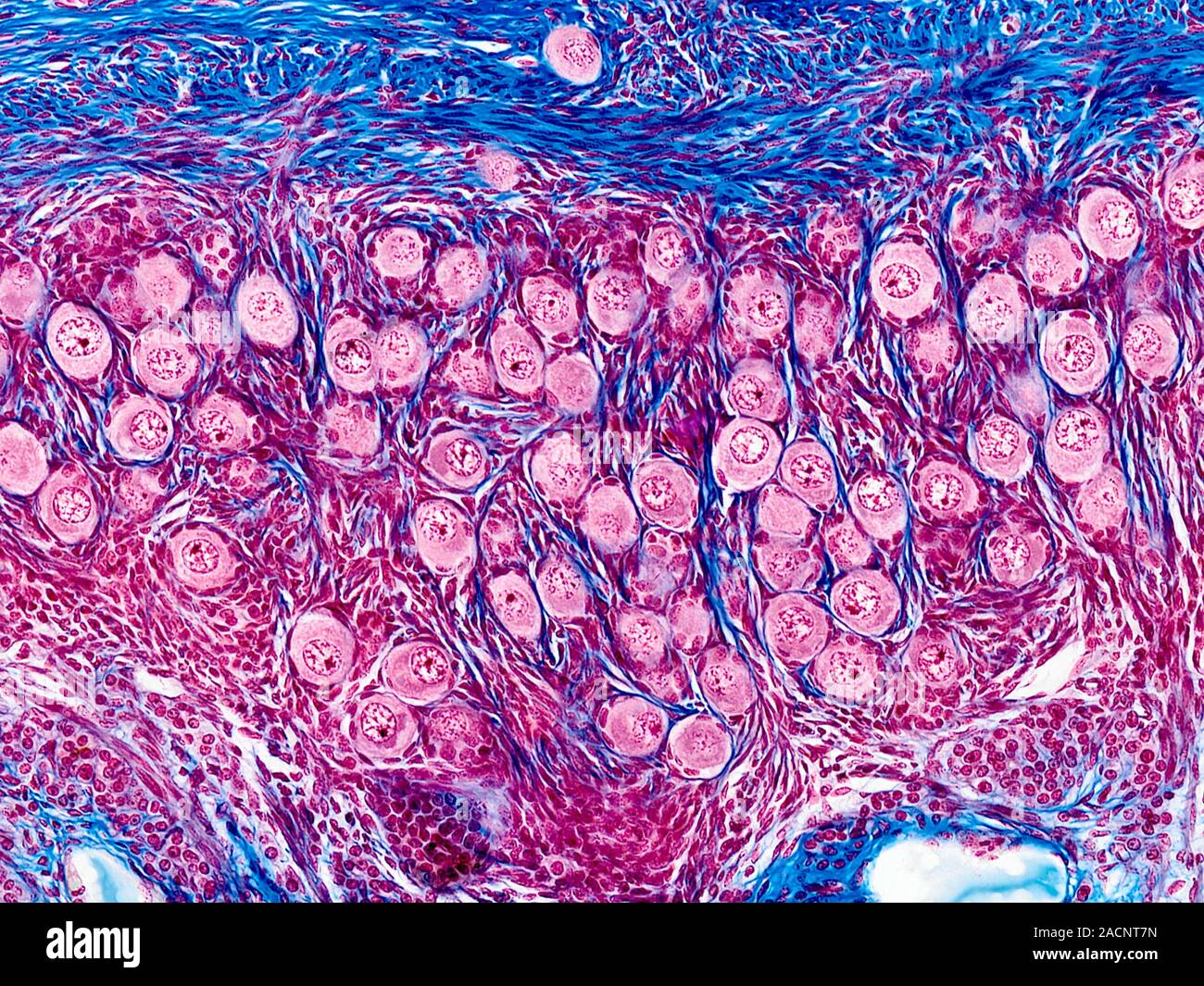 Ovarian follicles. Light micrograph of a section through a foetal ovary ...