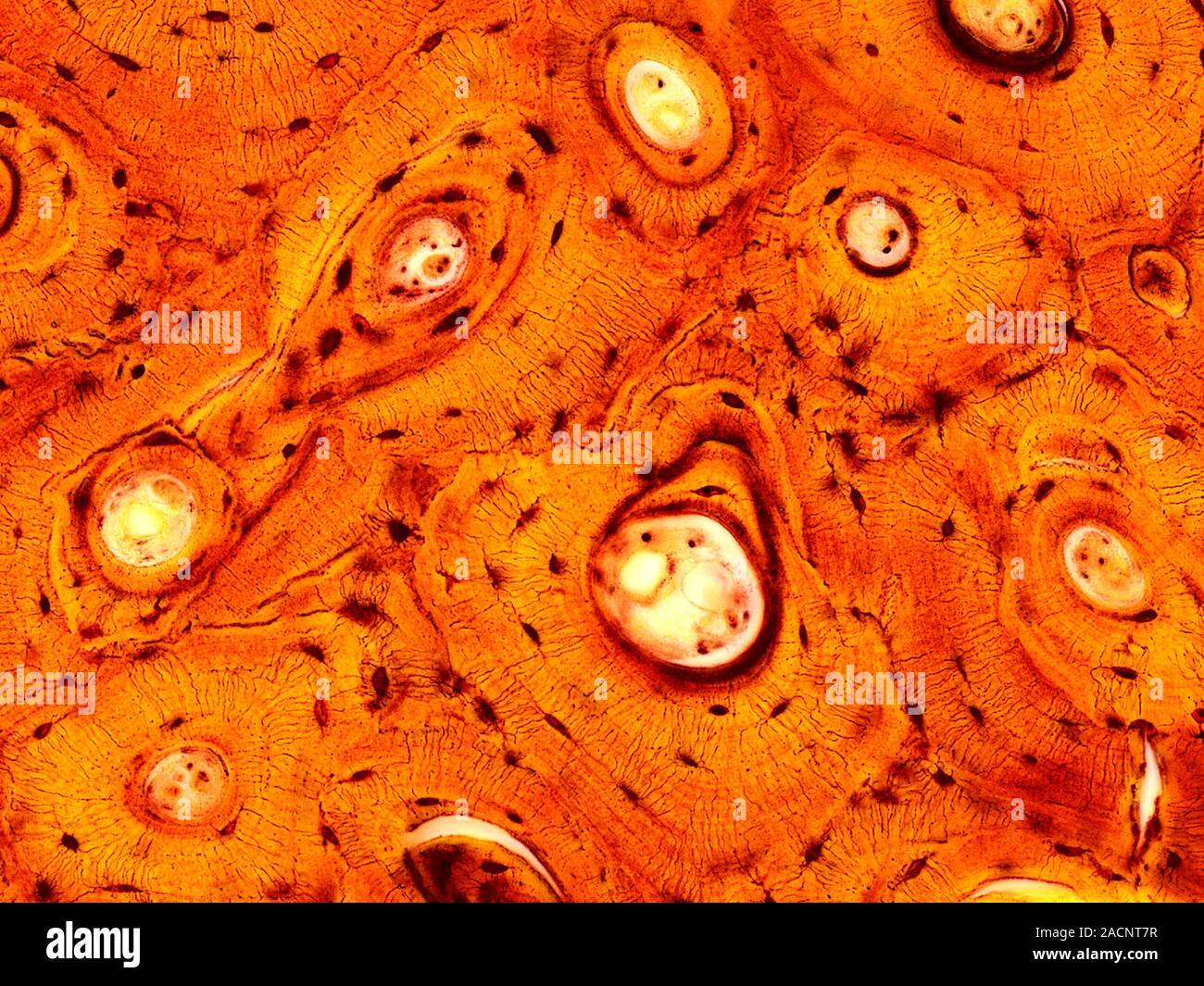 Compact bone, light micrograph. Compact bone consists of concentric ...