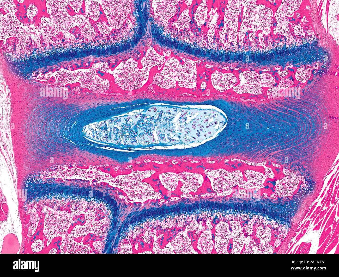 Histologia Do Disco Intervertebral Intervertebral Disk An Overview