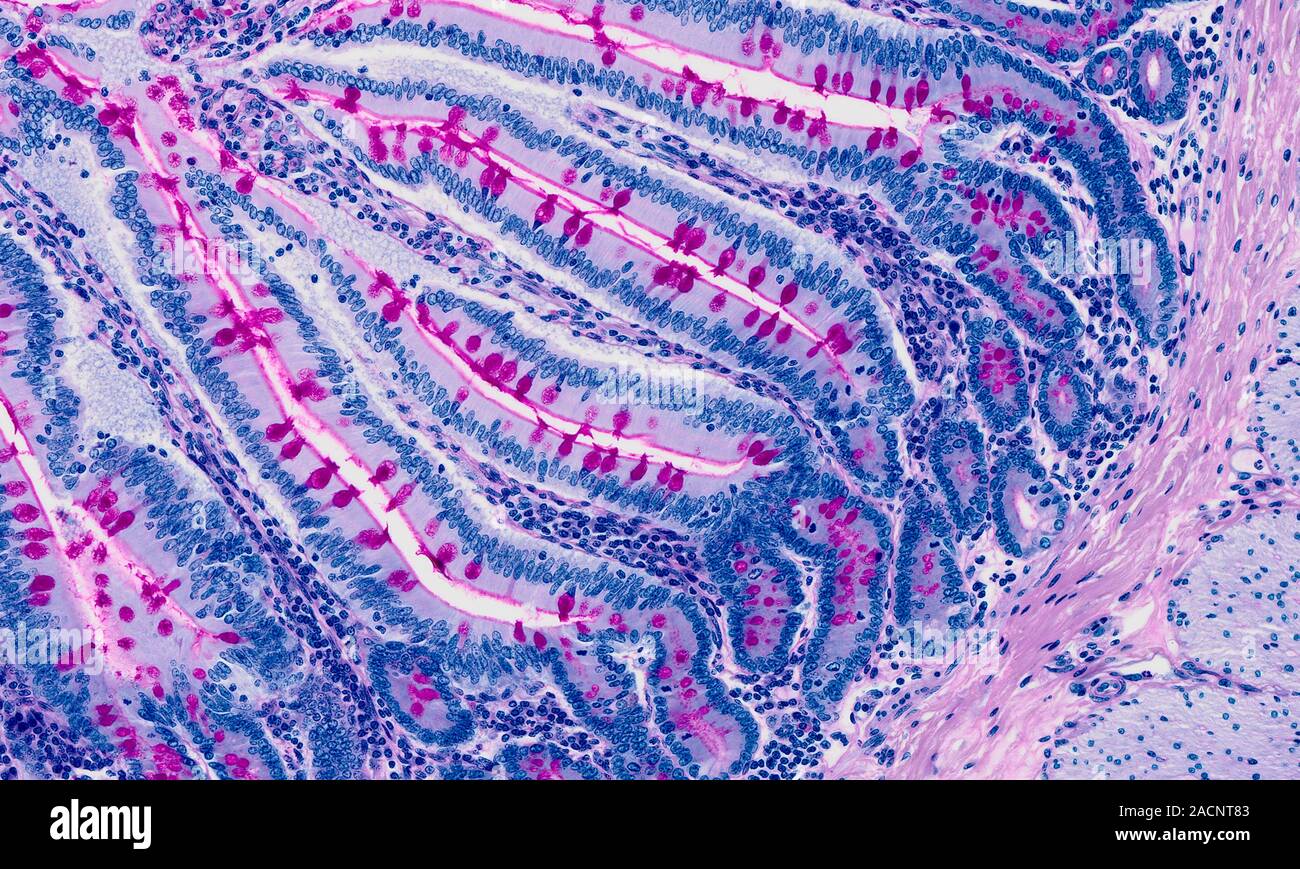 Small intestine. Light micrograph of a section through the small ...