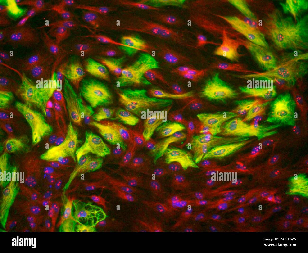 Astrocyte brain cells. Fluorescence light micrograph of primary ...