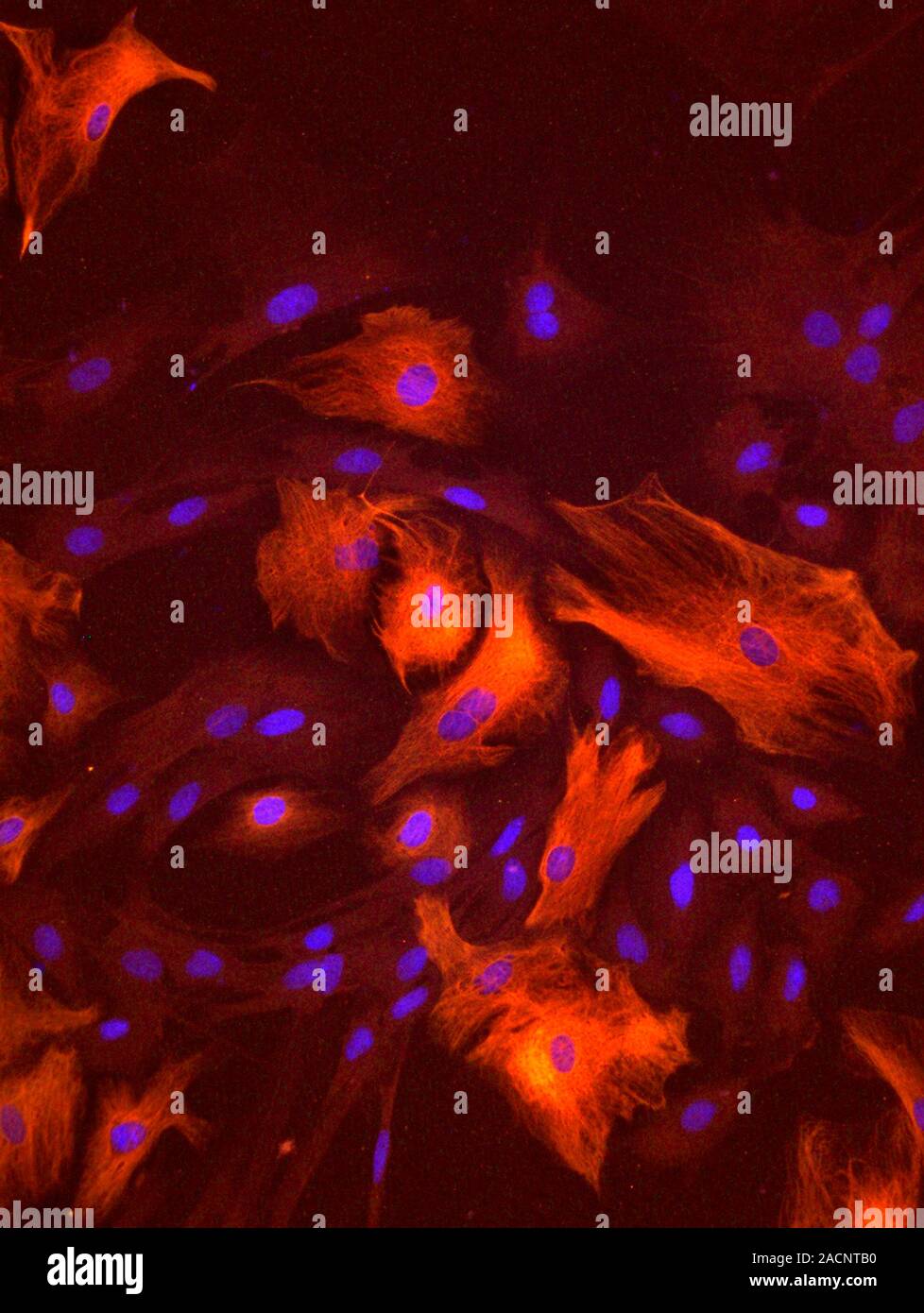 Astrocyte brain cells. Fluorescence light micrograph of primary ...