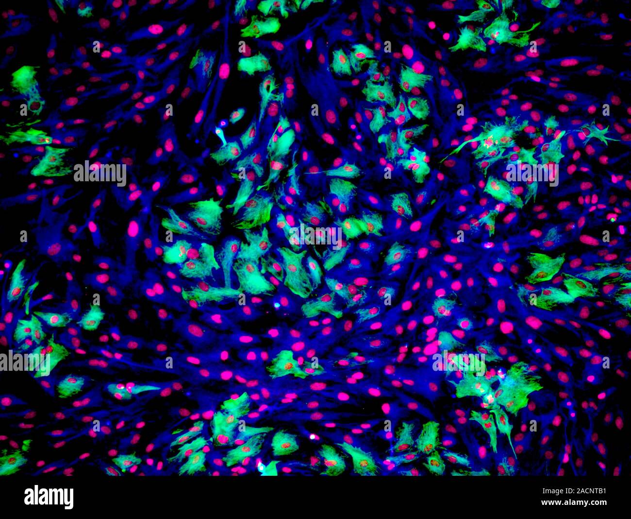 Astrocyte brain cells. Fluorescence light micrograph of primary ...