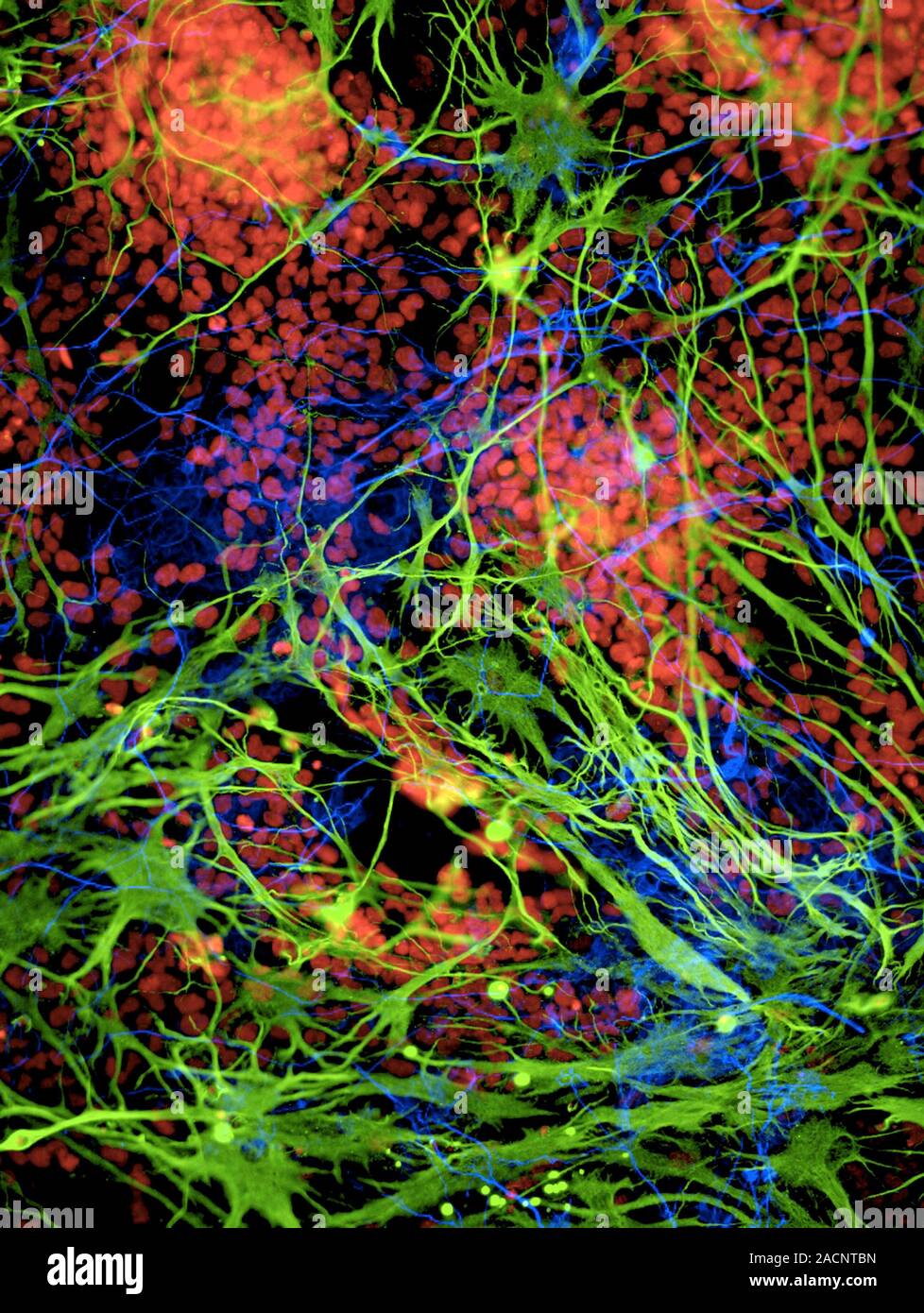 Stem cell-derived nerve cells. Fluorescence light micrograph of neural ...