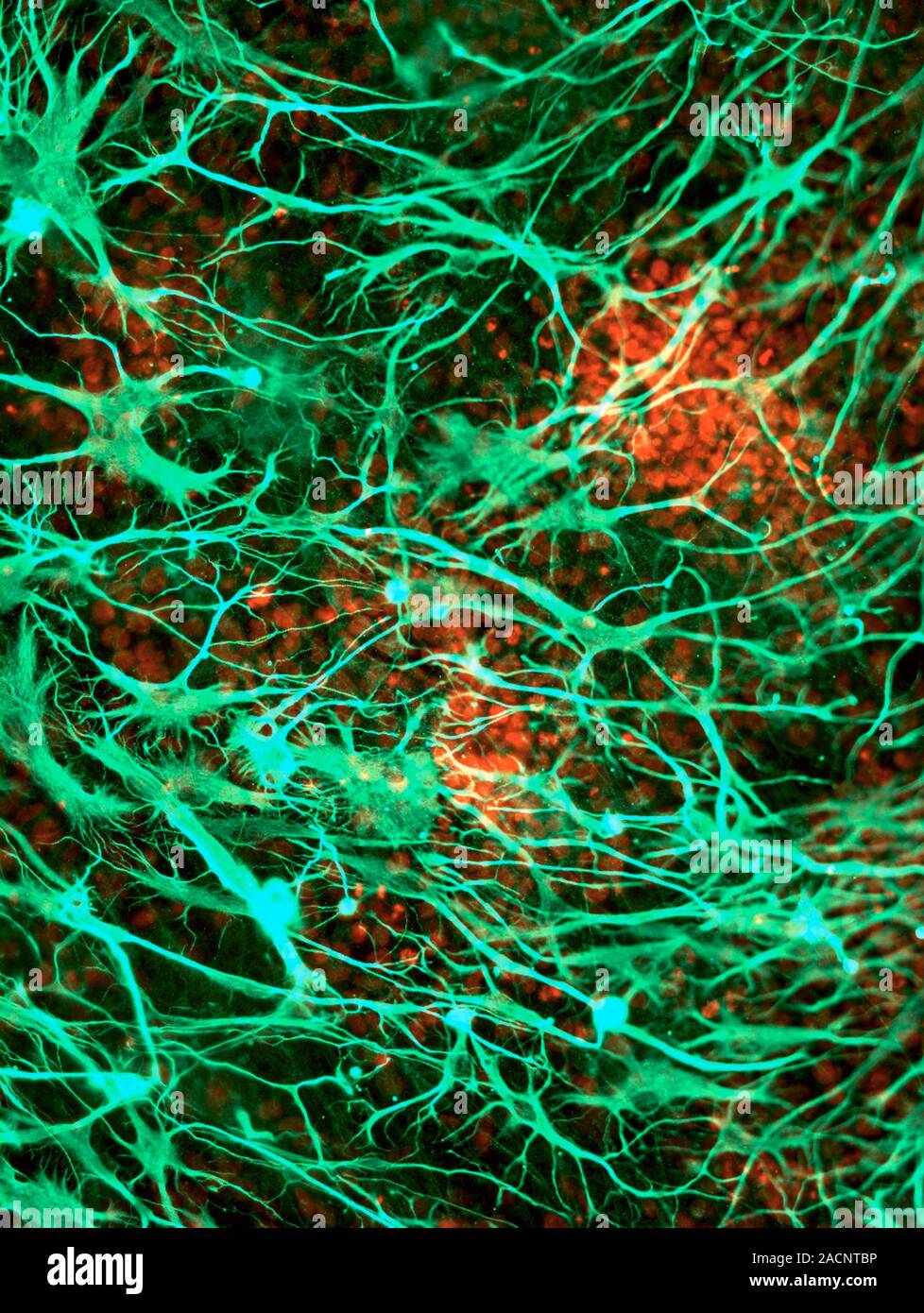 Stem cell-derived nerve cells. Fluorescence light micrograph of neural ...